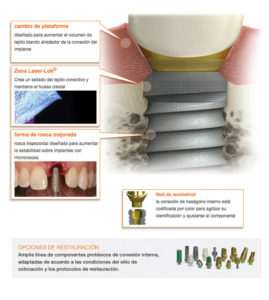 Tapered Internal Plus - Biodental